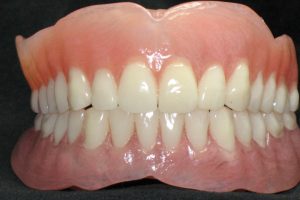Medical Card Dentures available at Cavan Denture Clinic